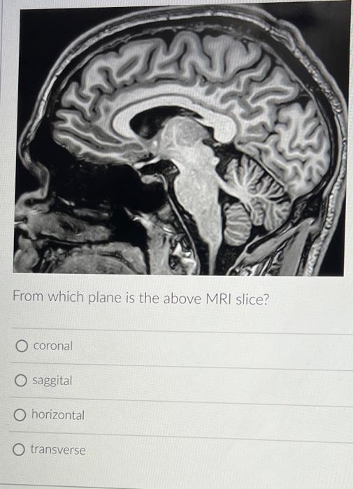 Solved From which plane is the above MRI slice? coronal | Chegg.com