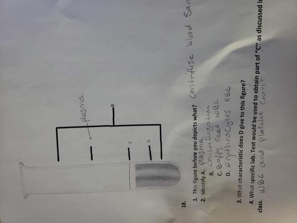 Solved Aplasma 18. 1. This figure before you depicts what? | Chegg.com