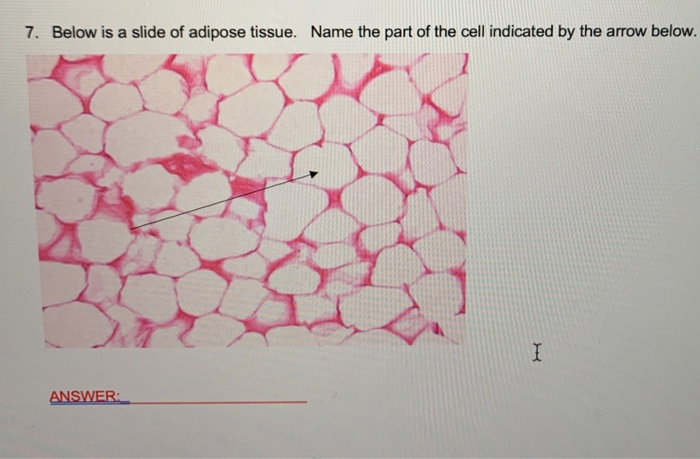 Solved 3. Define resolution (as it applies to microscopy). | Chegg.com
