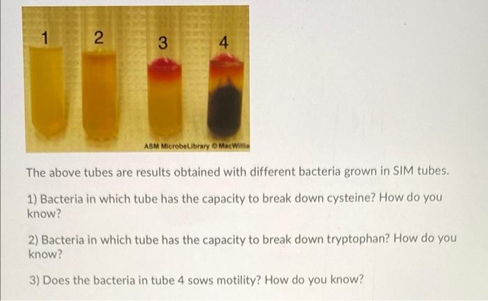 Solved 2 3 4 ASM MicrobeLibrary o MacWillia The above tubes | Chegg.com
