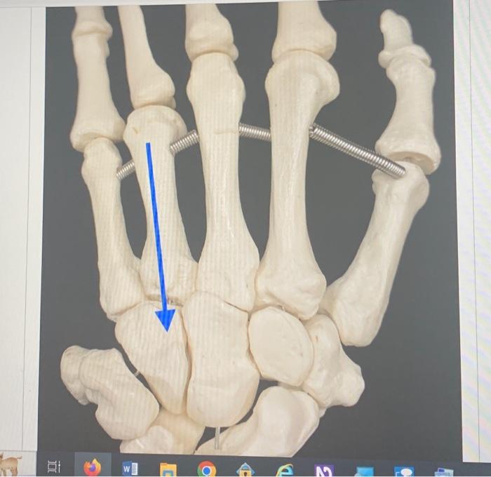 Solved Name the bone and the bone feature (Anterior | Chegg.com
