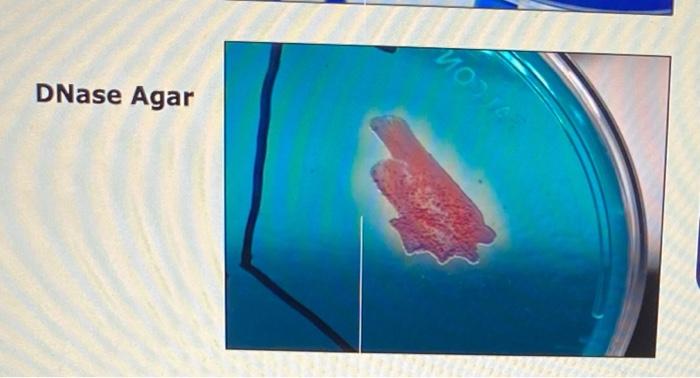 Solved Describe your observations of the DNase Agar test: a. | Chegg.com