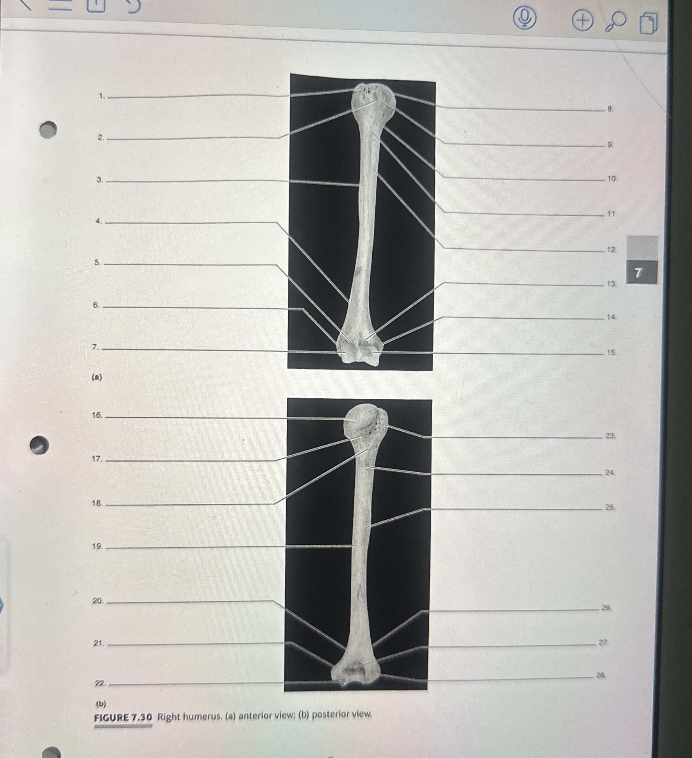 (b)FIGURE 7.30 ﻿Right humerus. (a) ﻿anterior view; | Chegg.com