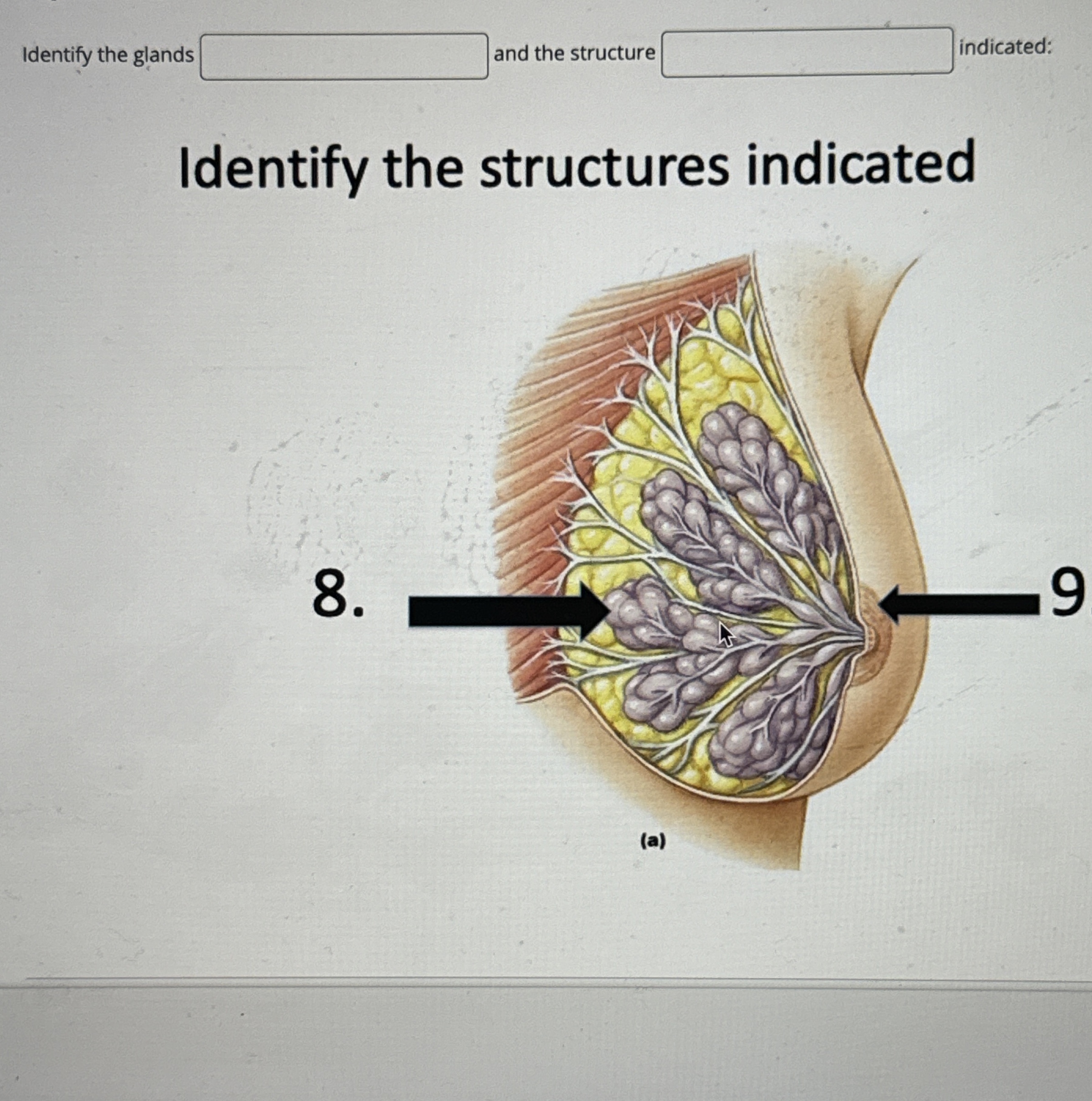 Solved Identify the glanc ﻿nd the structure q, ﻿indicated: | Chegg.com