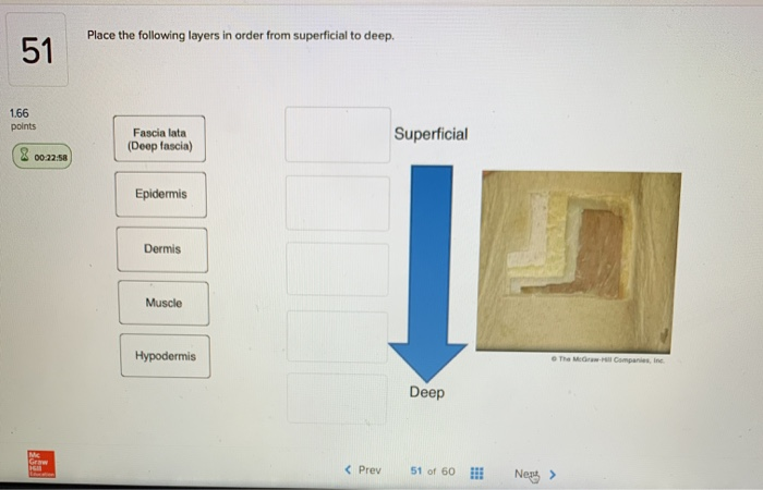 Solved Correctly identify this gland and label its parts. | Chegg.com