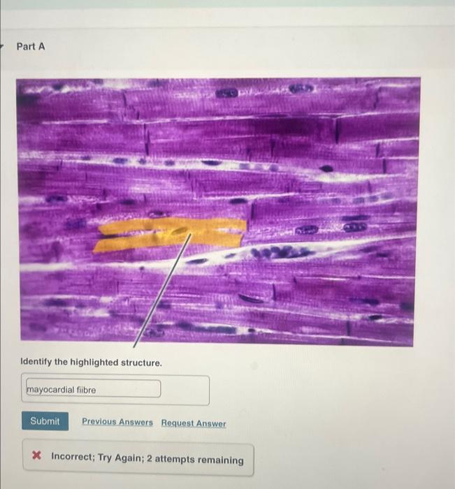 Solved Identify the highlighted structure. | Chegg.com