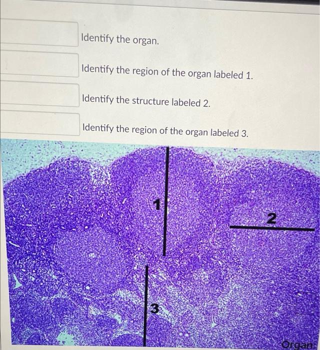 Identify the organ. Identify the region of the organ | Chegg.com
