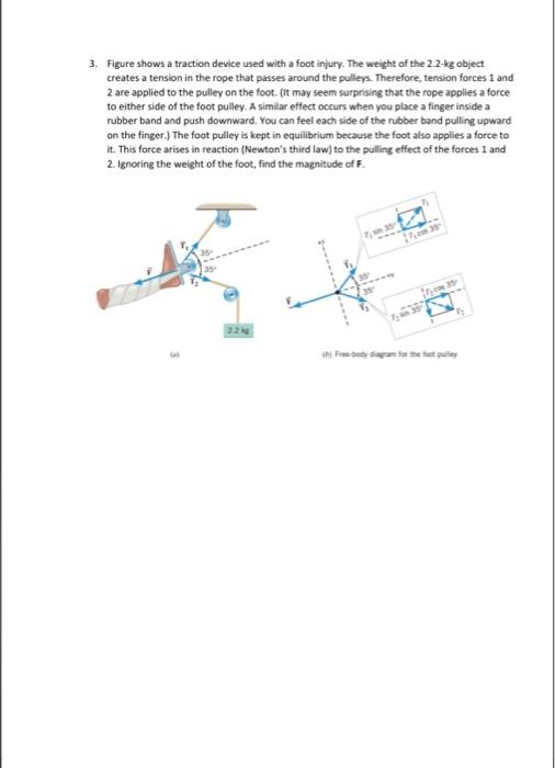 Solved 3. Figure shows a traction device used with a foot | Chegg.com