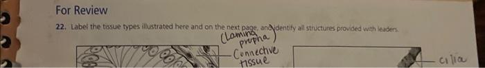 Solved (1) (9) Bone ADA 6 K Adipose tissue (*)_strated | Chegg.com