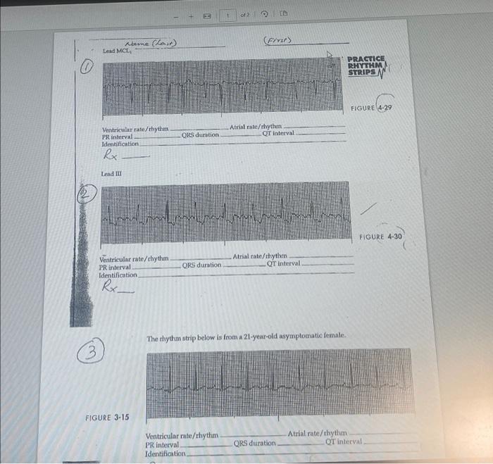 Solved 0 Name (Last) Lead MCL1 Ventricular rate/rhythm. PR | Chegg.com