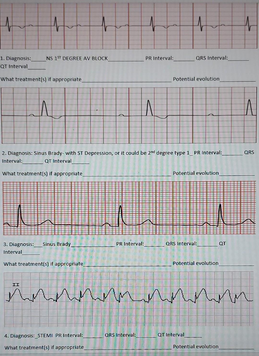 Solved 1 4 NS 1ST DEGREE AV BLOCK PR Interval: QRS Interval: | Chegg.com