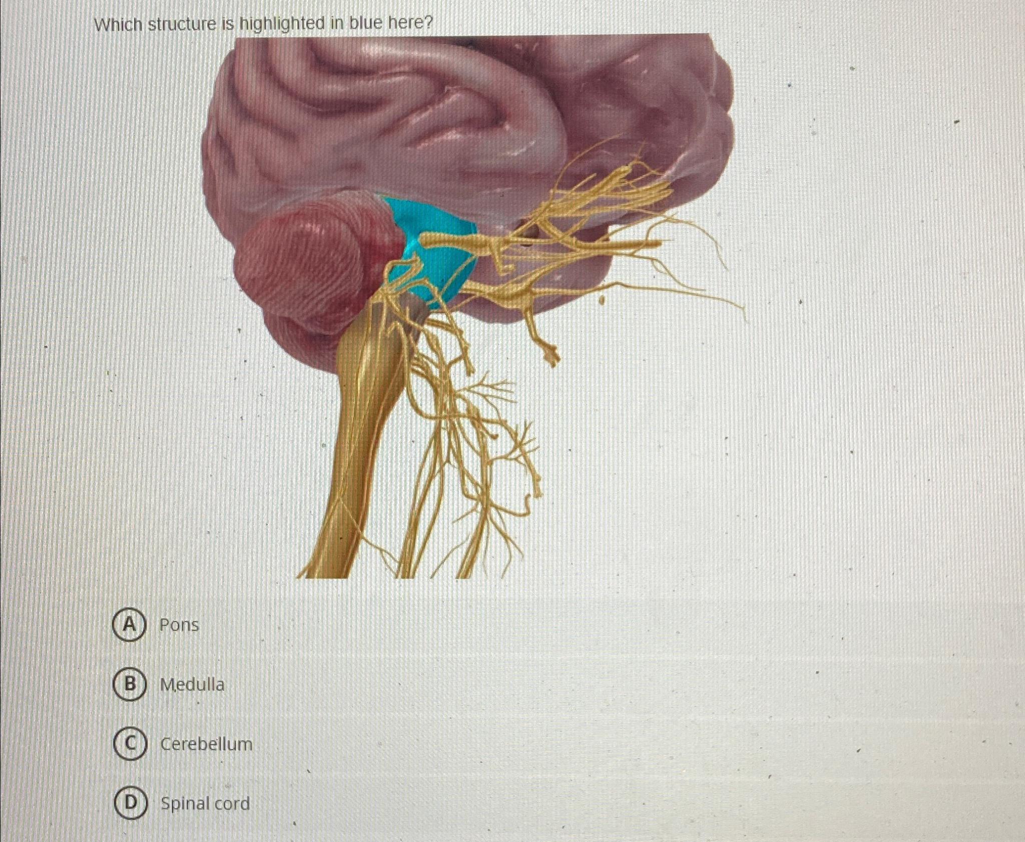 Solved Which structure is highlighted in blue here? | Chegg.com