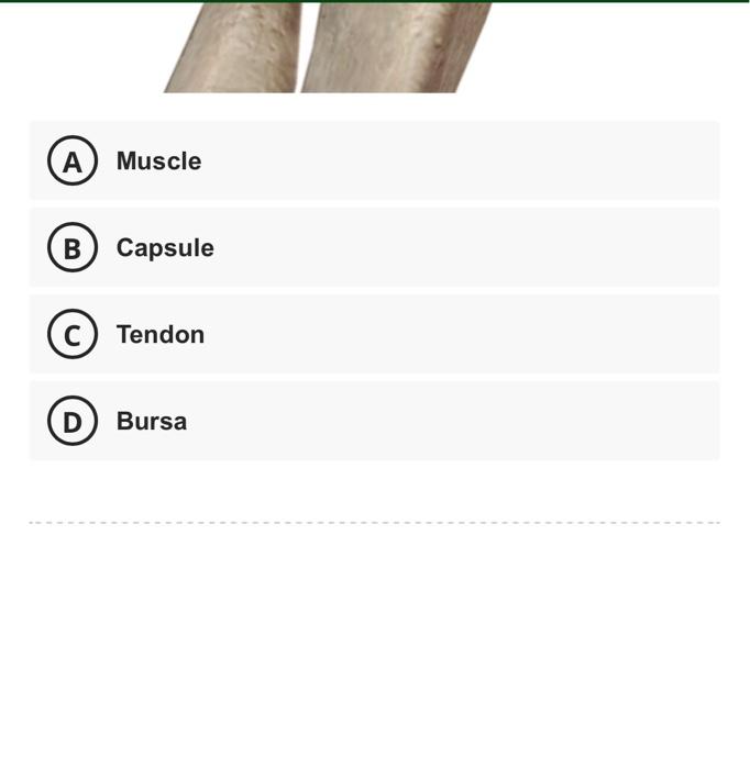 Solved Which structure is highlighted in blue? (A) | Chegg.com