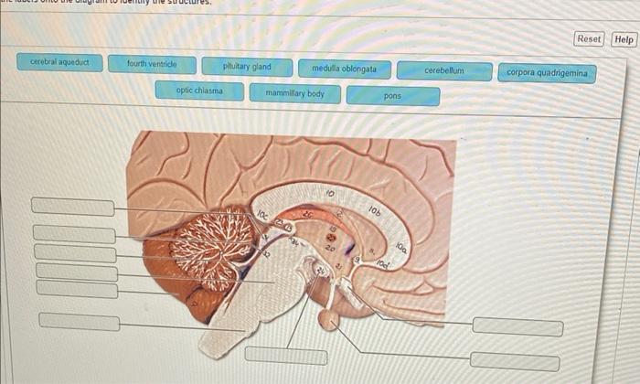 please match all 4 questions label exercises1)2)3)4) | Chegg.com