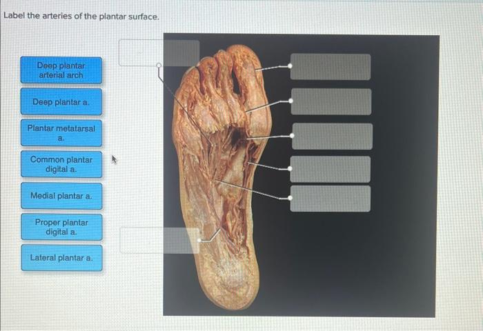 Solved Label the arteries of the plantar surface. | Chegg.com