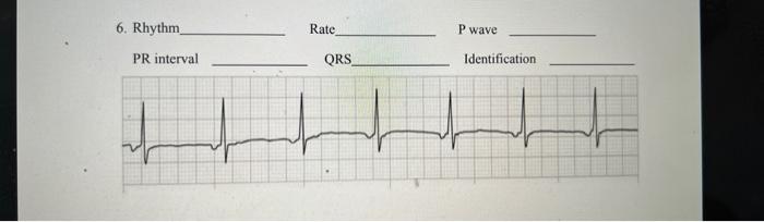 Solved 6. Rhythm Rate P wave PR interval QRS Identification | Chegg.com