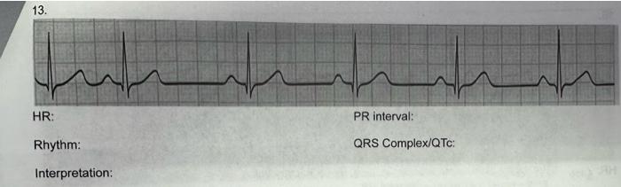 Solved 13. Interpretation:14. Interpretation: Paced atrial | Chegg.com