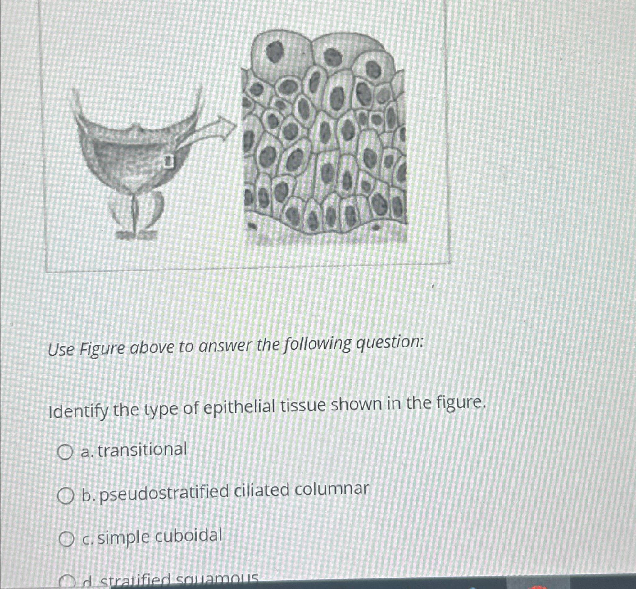 Solved Use Figure above to answer the following | Chegg.com