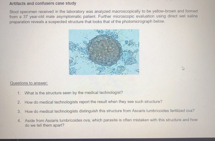 Solved Artifacts and confusers case study Stool specimen | Chegg.com