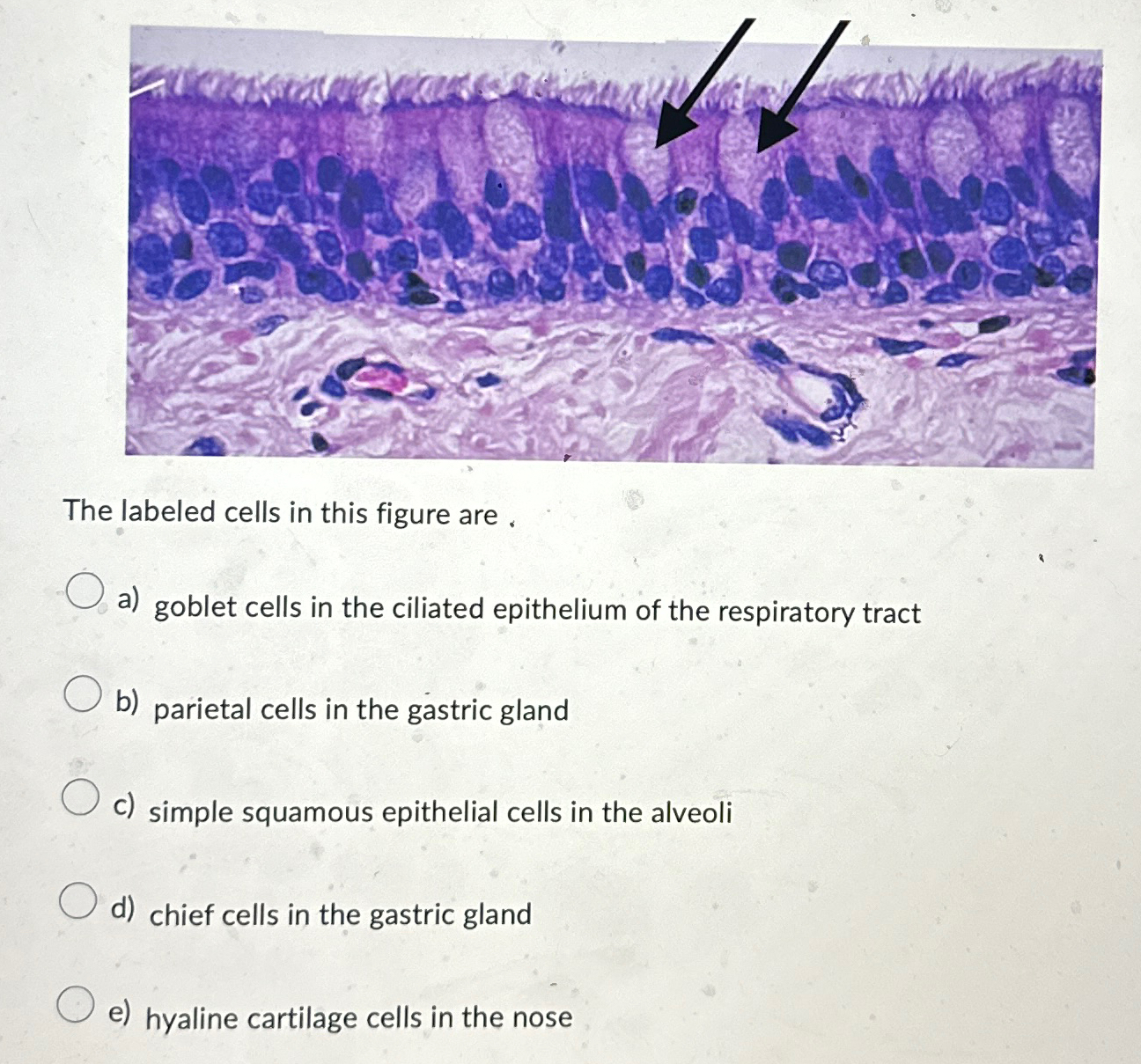The labeled cells in this figure are .a) ﻿goblet | Chegg.com