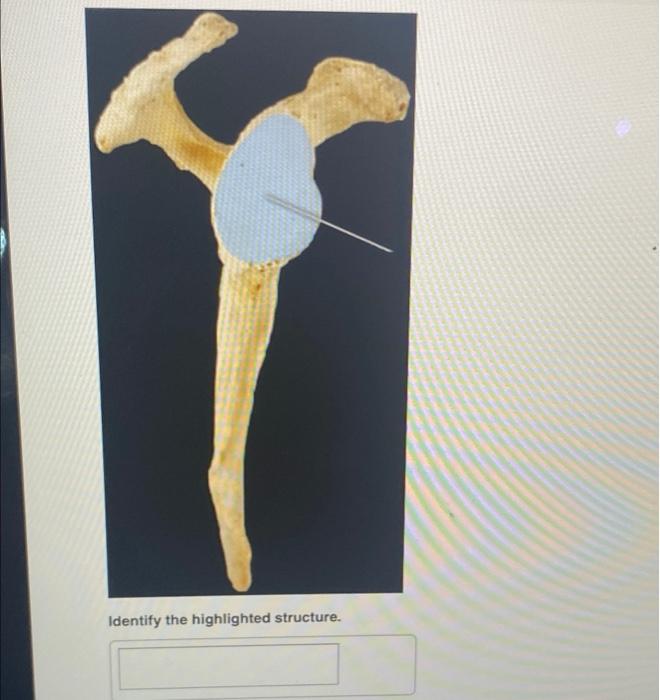 Solved Y Part A 健 Identify the highlighted bones. Identify | Chegg.com