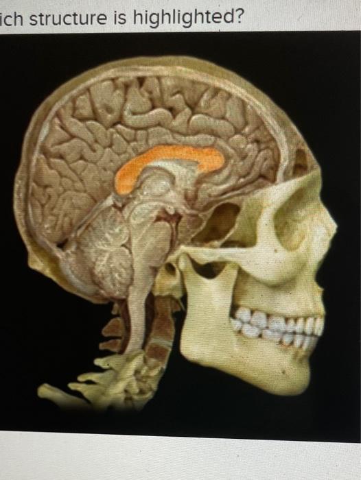 Solved ich structure is highlighted? | Chegg.com