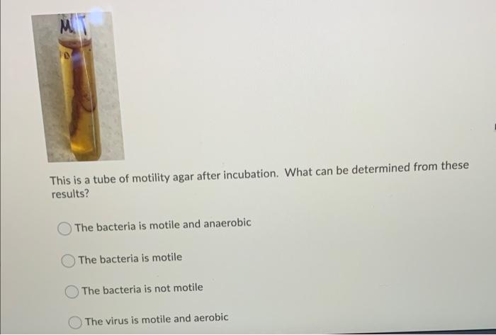 Solved M This is a tube of motility agar after incubation. | Chegg.com