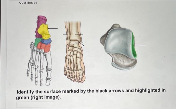 Solved QUESTION 2 Identify the passageway marked by the | Chegg.com