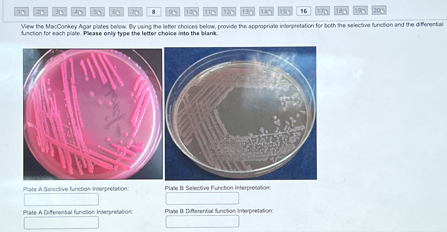 Solved View the MacConkey Agar plates below. By using the | Chegg.com