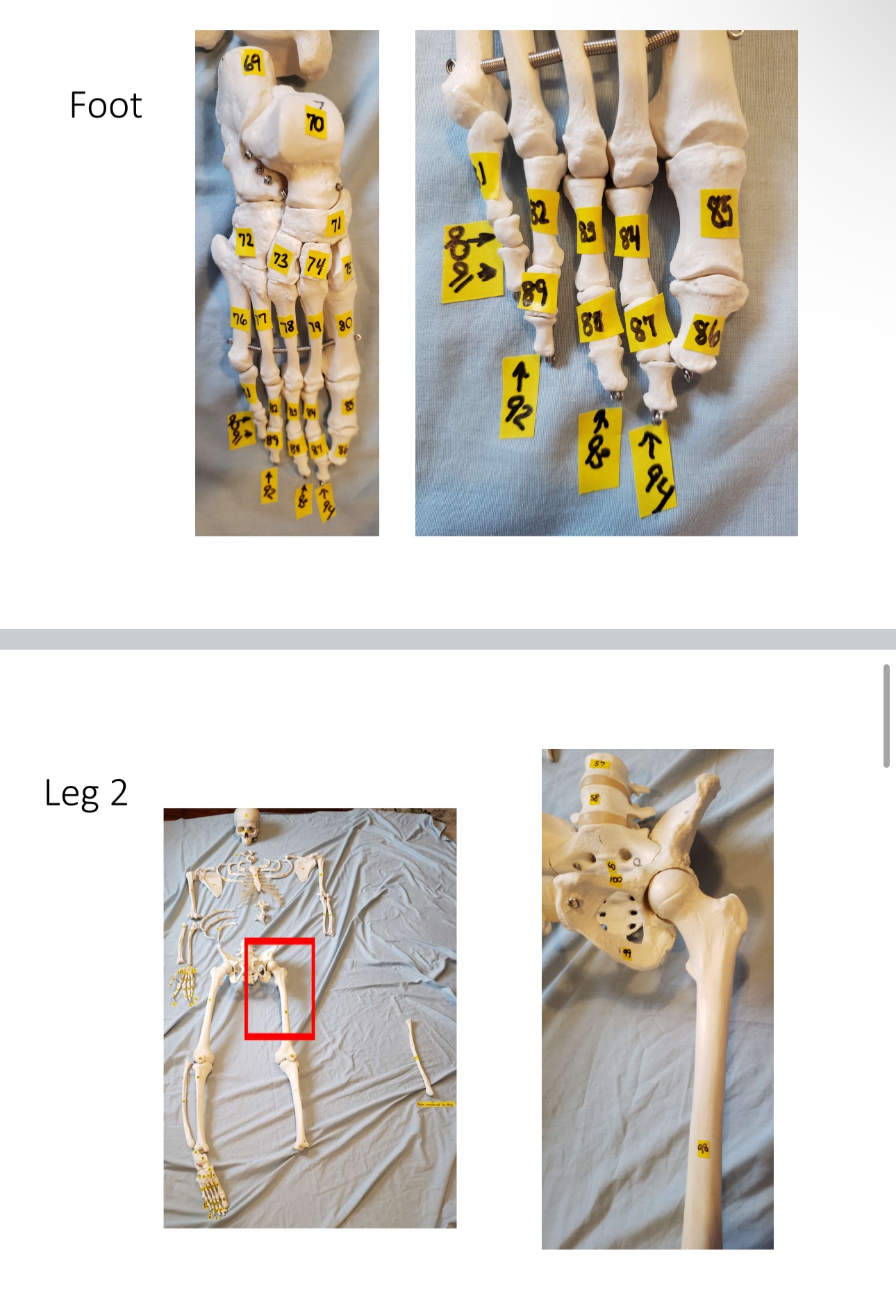 Solved Bone names of all the yellow names | Chegg.com