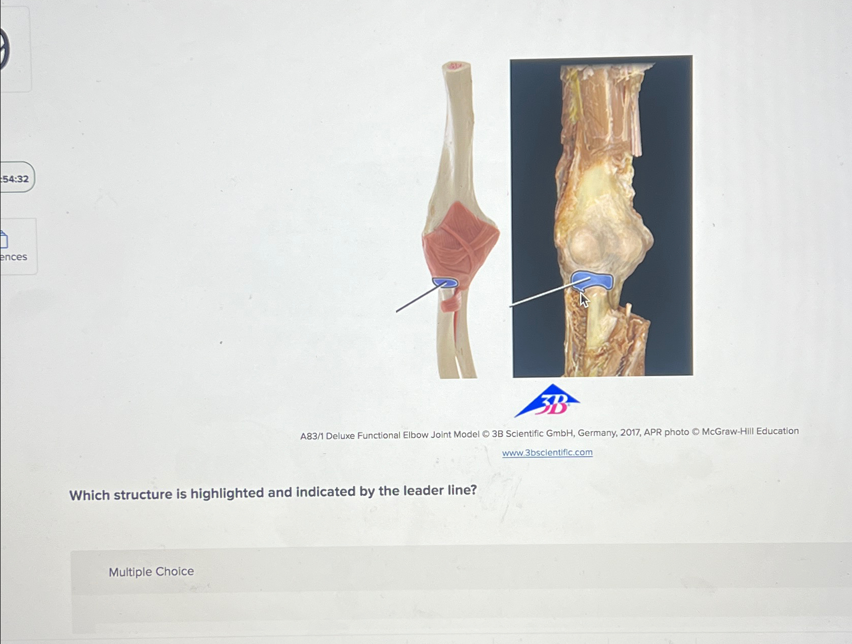 Solved A83/1 Deluxe Functional Elbow Joint Model o. 3B | Chegg.com Solved A83/1 Deluxe Functional Elbow Joint Model o. 3B | Chegg.com