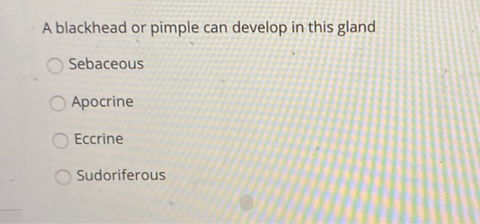 Solved Intercellular(extracellular) matrix is always elastic | Chegg.com