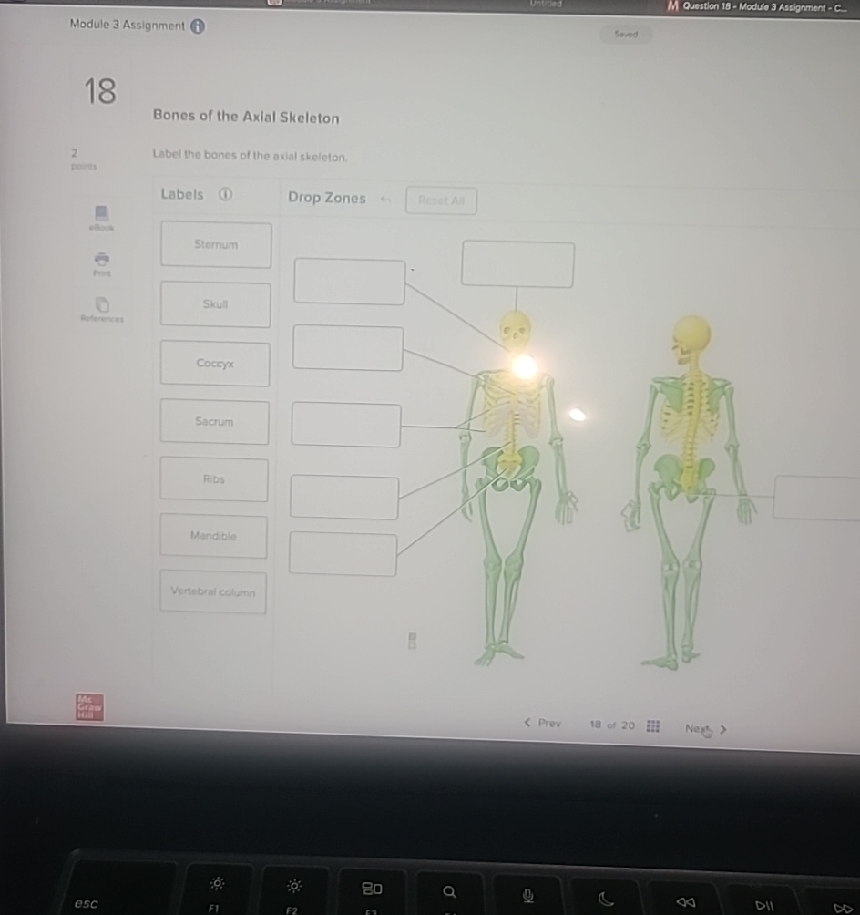Solved UntitadQuestion 18 - ﻿Modula 3 ﻿Assignment - | Chegg.com