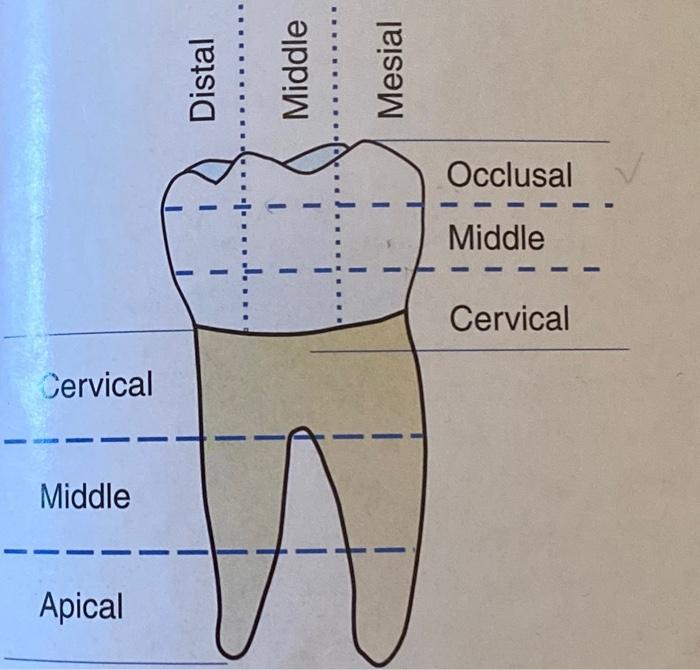 Solved can someone simply explain this dental terminolgy, | Chegg.com