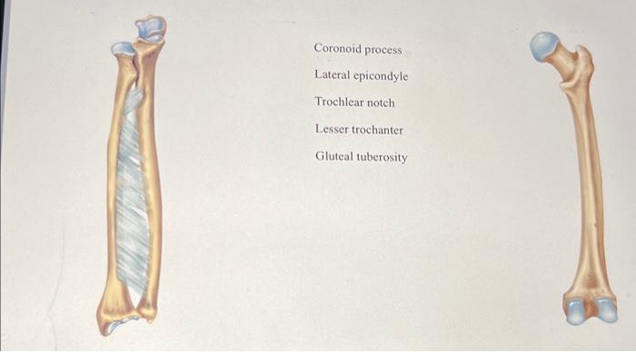 Solved Coronoid process Lateral epicondyle Trochlear notch | Chegg.com