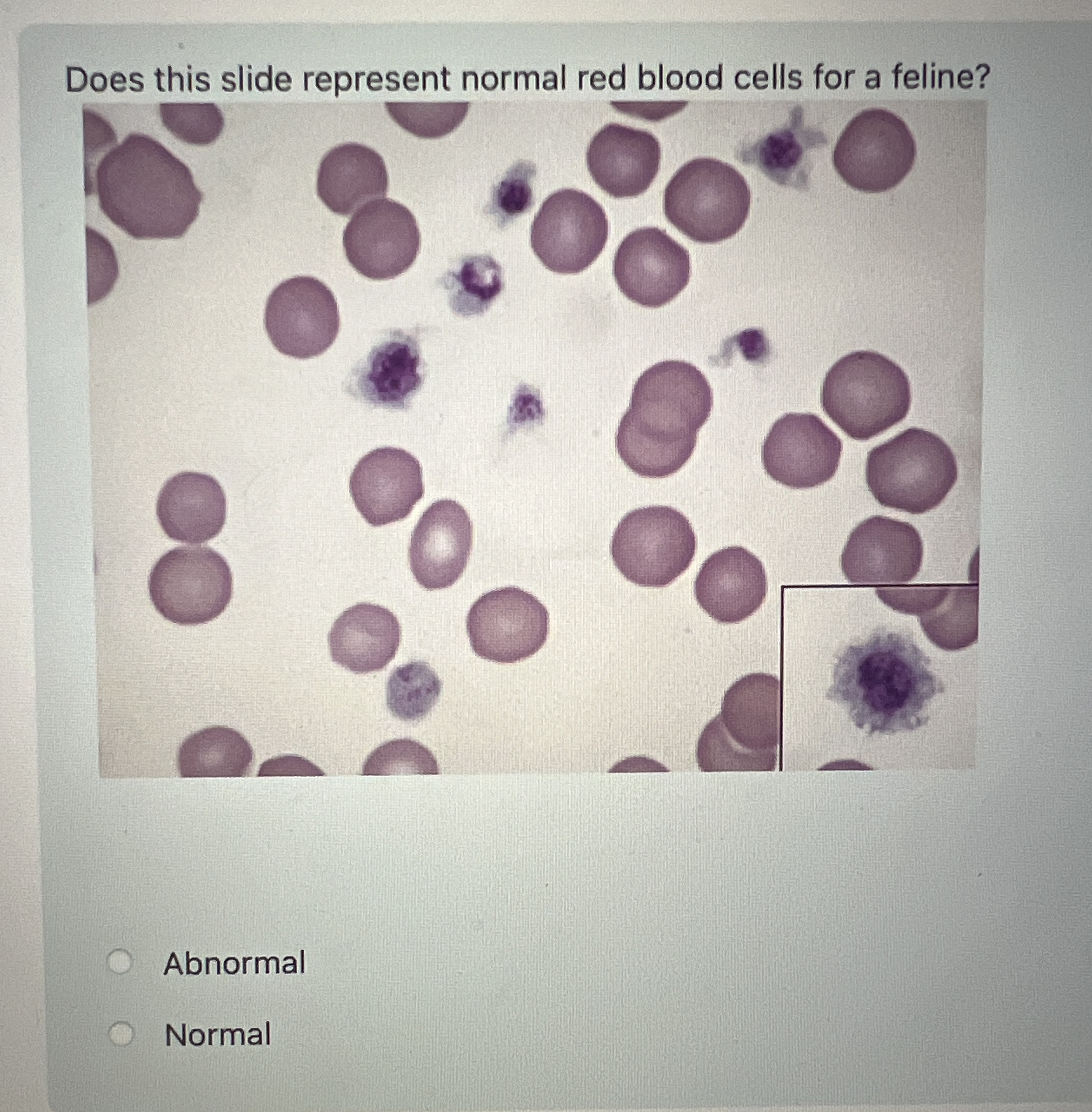Solved Does this slide represent normal red blood cells for | Chegg.com