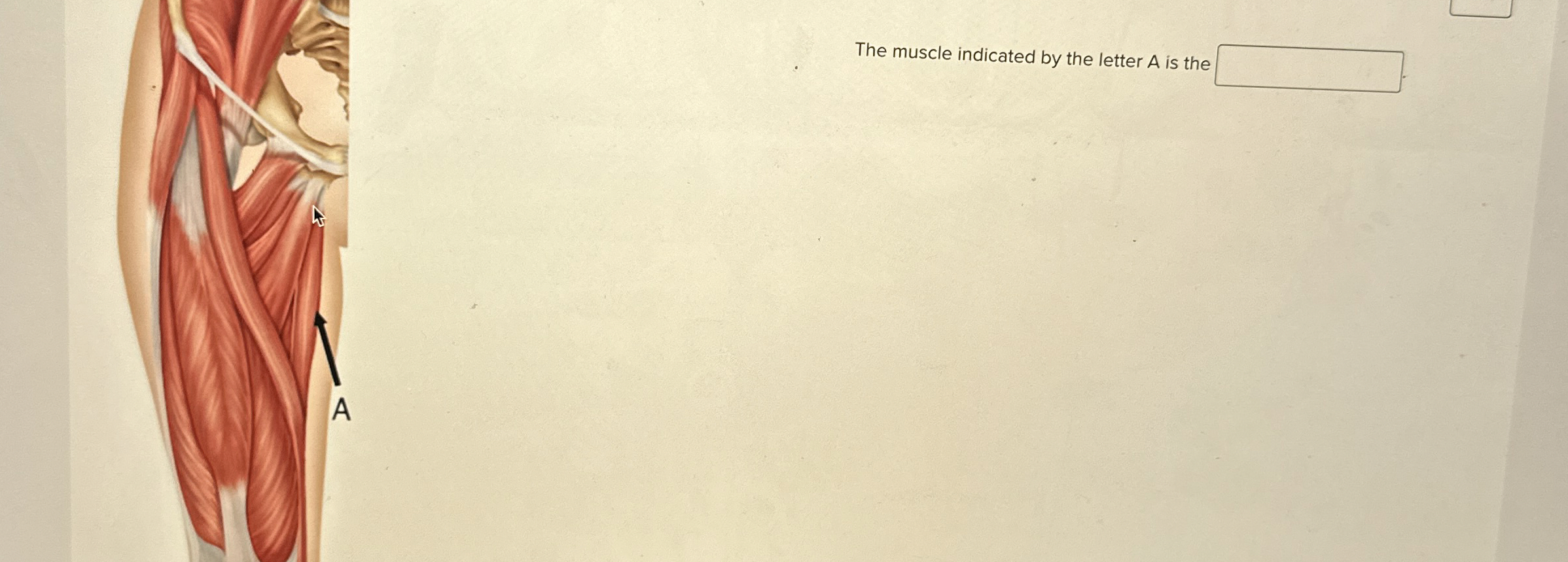 Solved The muscle indicated by the letter A ﻿is the | Chegg.com