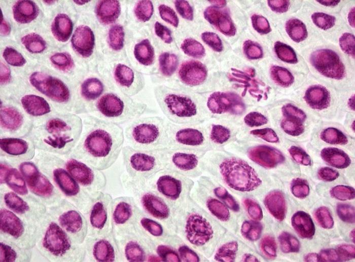 Solved Stage of the Cell Cycle Number of Cells Interphase | Chegg.com