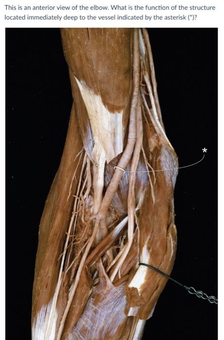 Solved This is an anterior view of the elbow. What is the | Chegg.com