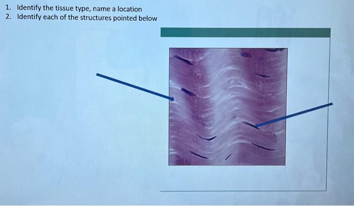 Solved Identify the name of each of the following tissue | Chegg.com