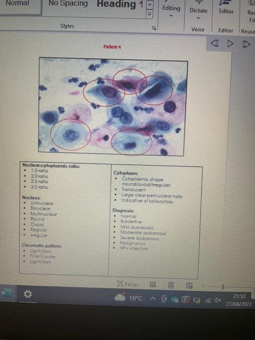 below are smear test result can you diagnoise the | Chegg.com