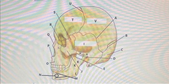 Solved 11 coronoid process 1. feature A 1 squamosal suture | Chegg.com