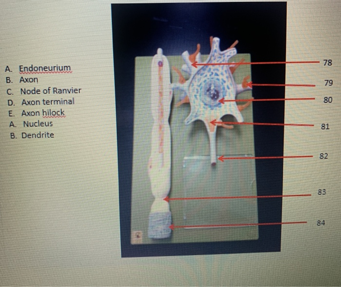Solved 78 79 A. Endoneurium B. Axon C. Node of Ranvier D. | Chegg.com