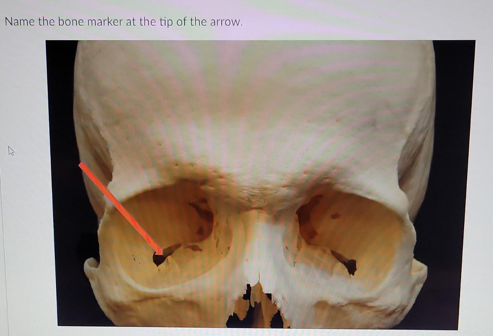 Solved Name the bone marker at the tip of the arrow. Name | Chegg.com