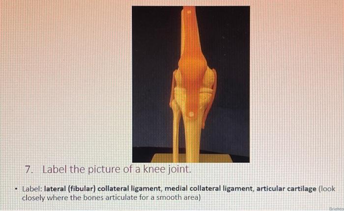 Solved 7. Label the picture of a knee joint. Label: lateral | Chegg.com