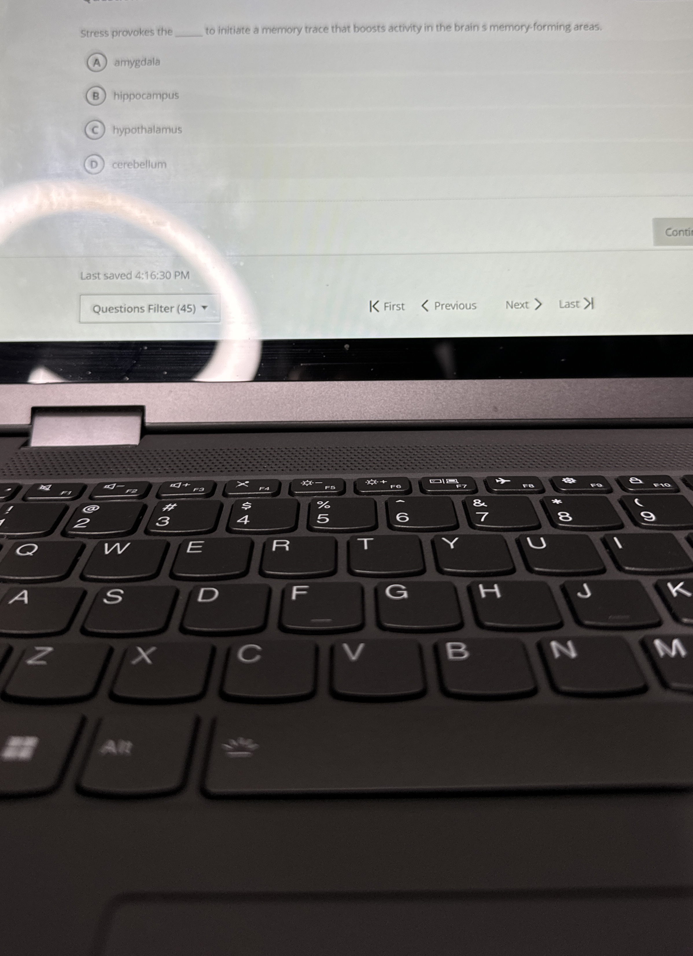 Solved stress provokes theto initiate a memory trace that | Chegg.com