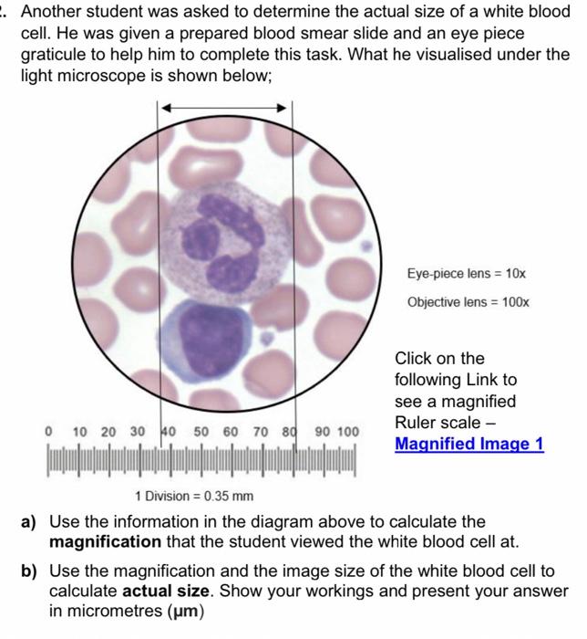 White Blood Cells Slide Labeled
