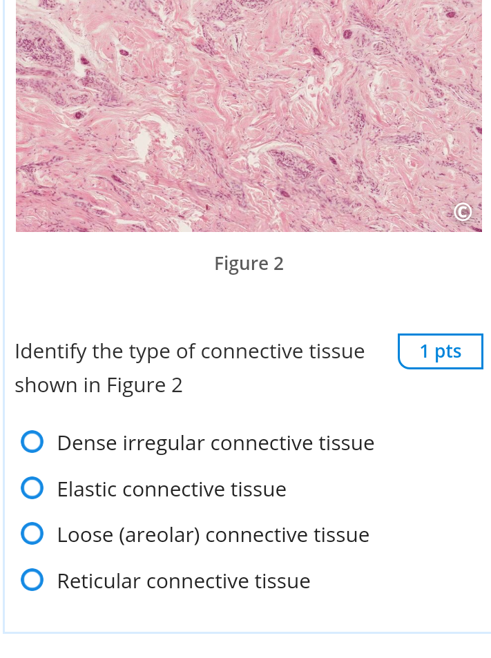Solved Figure 2 1 pts Identify the type of connective tissue | Chegg.com