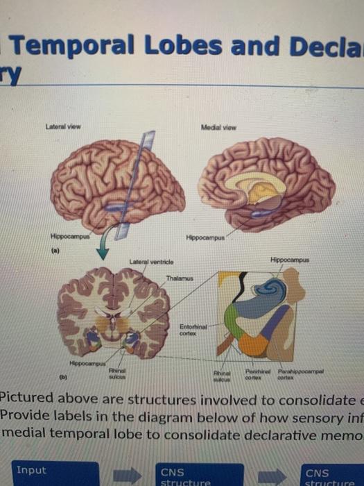 Solved 7. Medial Temporal Lobes and Declarative Memory a. | Chegg.com