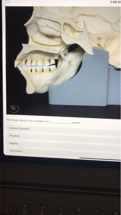 Solved 1:29:31 W The image above is an example of a Section | Chegg.com